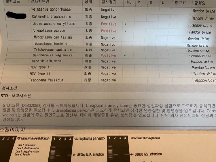 성병검사 std12종 검사결과 : 지식iN