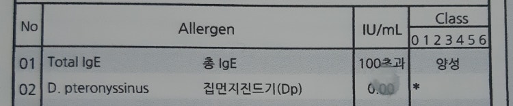 total lge가 뭔가요 : 지식iN