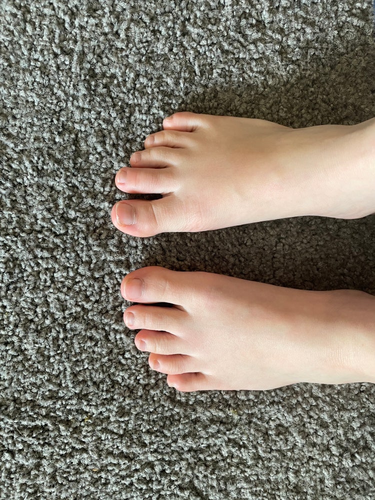 오른쪽 두번째 발가락과 왼쪽 세번째 네번째 발가락이 자주 부어요 가끔은 엄지발가락도 부어서 걷기 불편한 정도입니다 이러다가