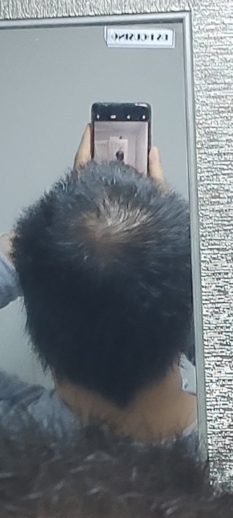 사진은 제 머리 카락인데 많이 얇나요그리고 정수리가 비어 보이는데 한 몇개월정도 기르면 정수리 커버 될까 지식in