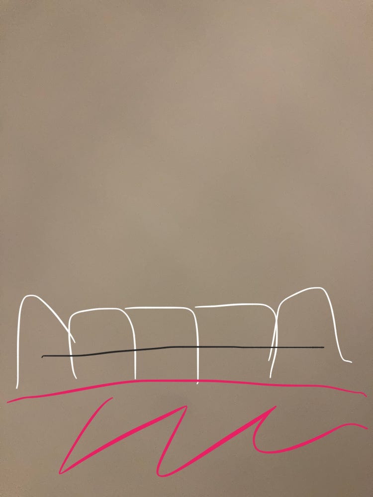 교정 꼈다가 뺐다가 하는 장치중 앞이빨 뒤에 붙여있는 철사 지식in