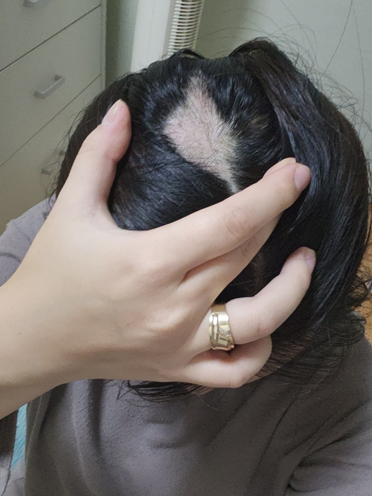 머리아픔 식은땀 속울렁 어지러움 가운데배찌릿 지식in