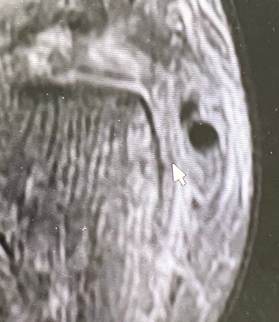 CFL grade : 지식iN