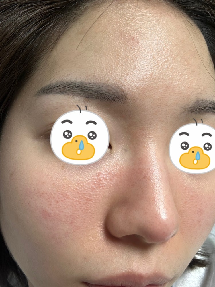 제 피부는 왜 이럴까요 모공관련 피부연고나 스킨 로션 제품 추천해주세요 지식in