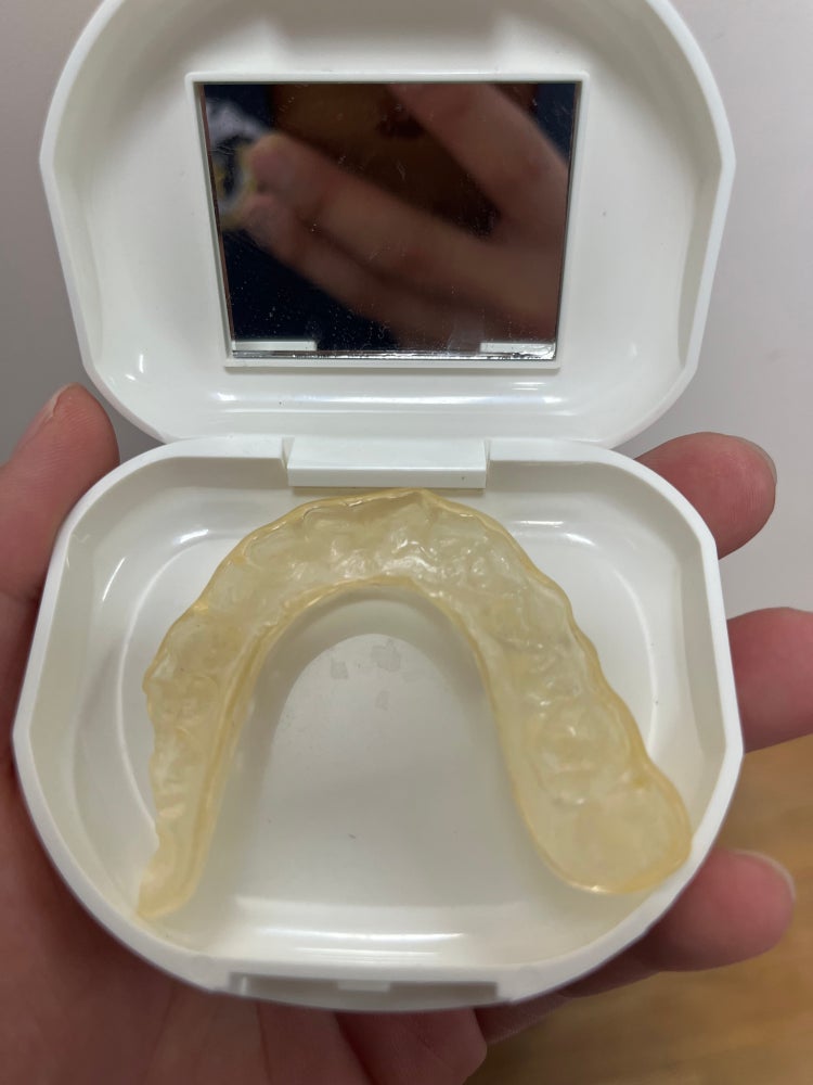 이갈이장치 가장자리가 살짝 부숴졌는데 사용할수 있나요 지식in