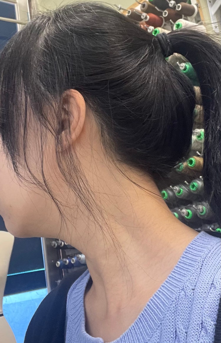 턱살 많은편인가요? : 지식iN