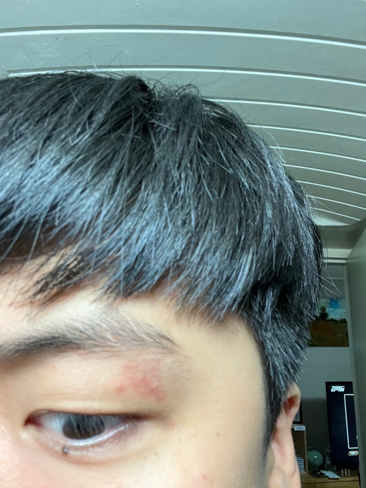 눈에 이거 뭔 가요 : 지식iN