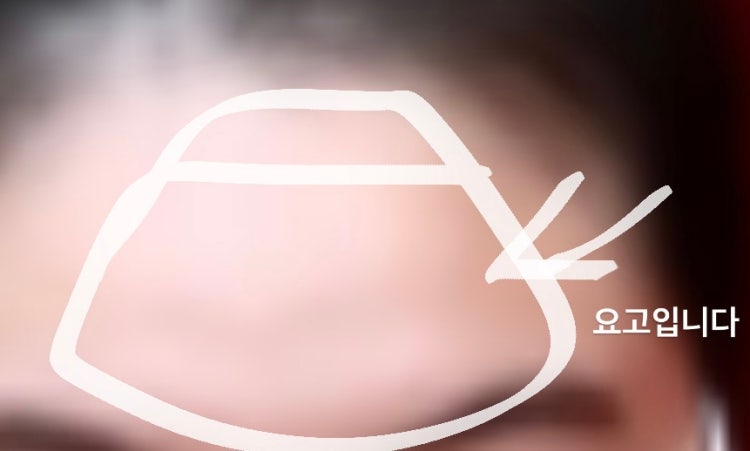 [급함]이마에 주름살?? 보정 : 지식iN