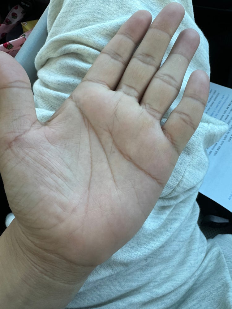 진드기 유충으로 보이는데 급합니다 지식in