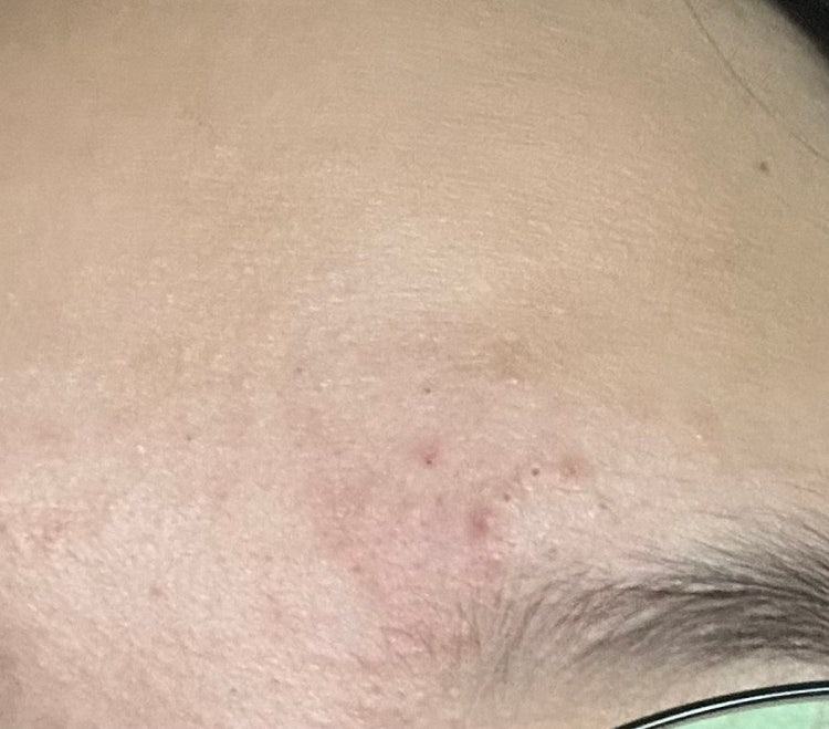 이런 피부 관리 어떻게 해야하죠 지식in