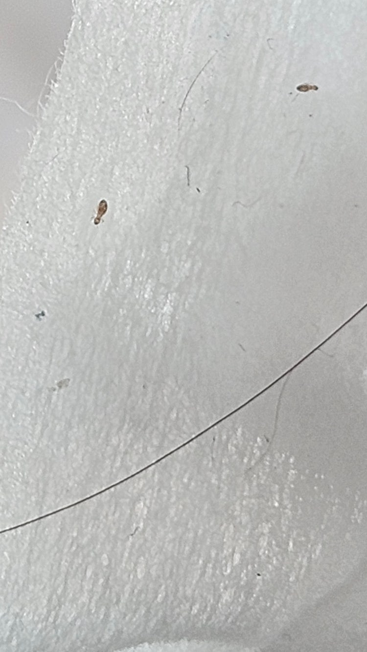 무슨 진드기같은거인가요 지식in