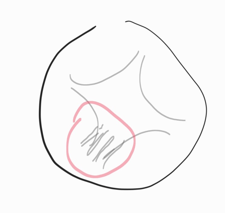 이빨 이거 병원 가야할까요? : 지식iN